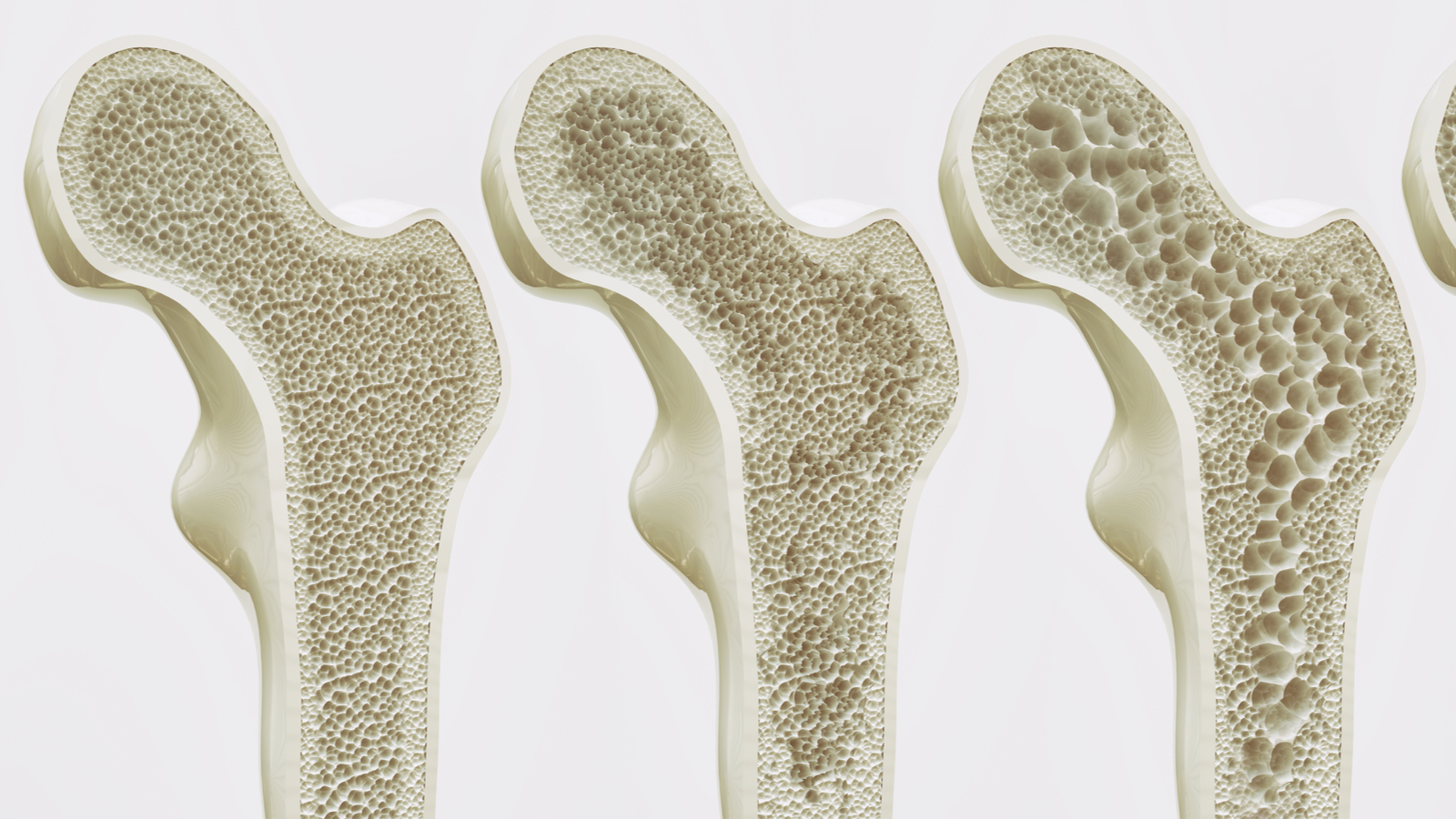 Orthopaedic Services in Illinois | Orthopaedic Doctor Herrin | The ...