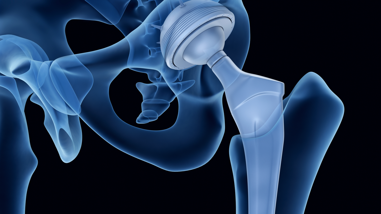 Orthopaedic Services in Illinois | Orthopaedic Doctor Herrin | The ...
